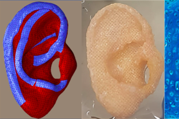 It’s Now Possible To 3D-Print A Customized Ear, Thanks To ‘Scaffolding ...