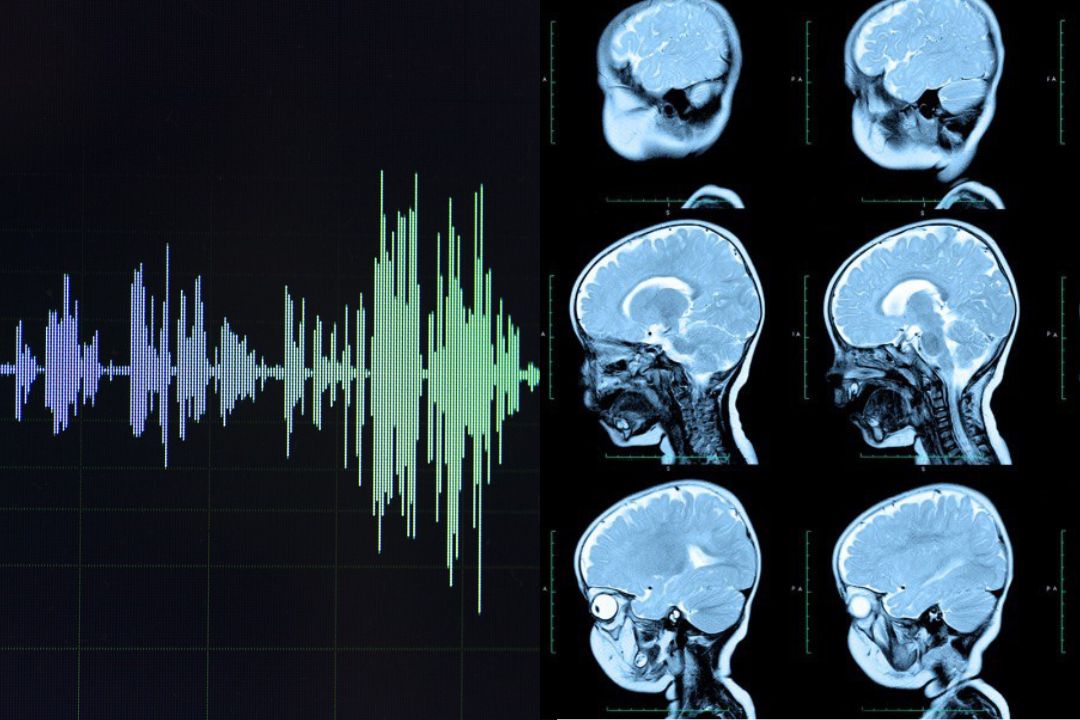 Google’s Music AI Generator Can Transform Your Brain Scans Into Actual ...