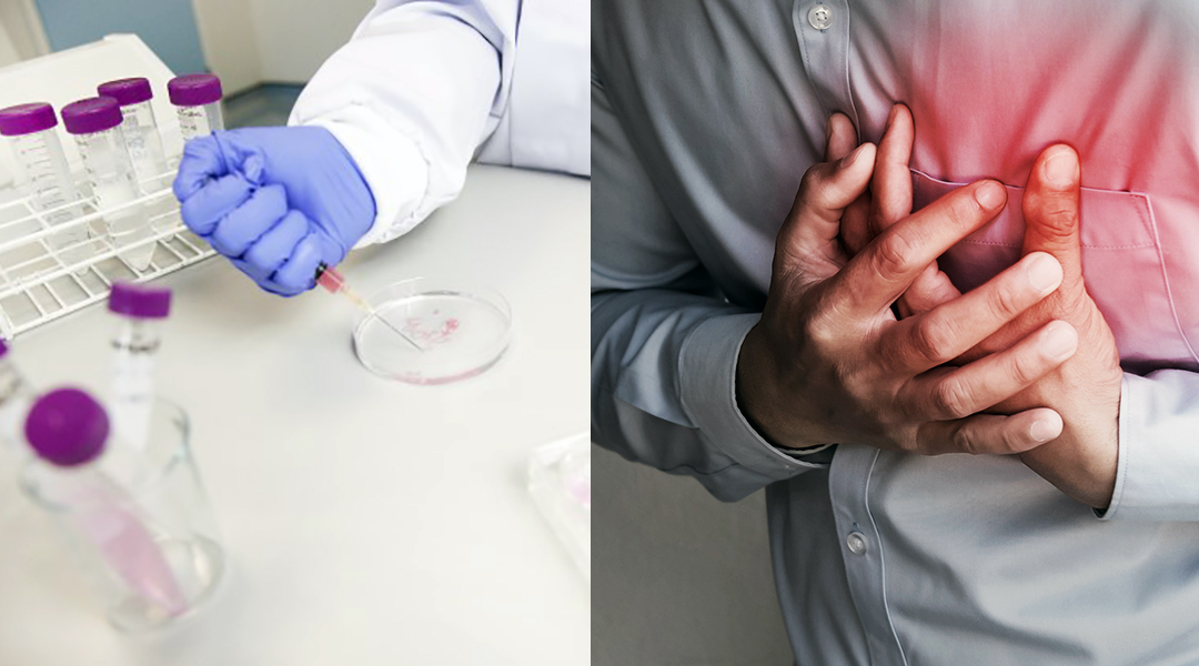 Scientists Develop Injectable Gel That Can Repair Damage After Heart ...